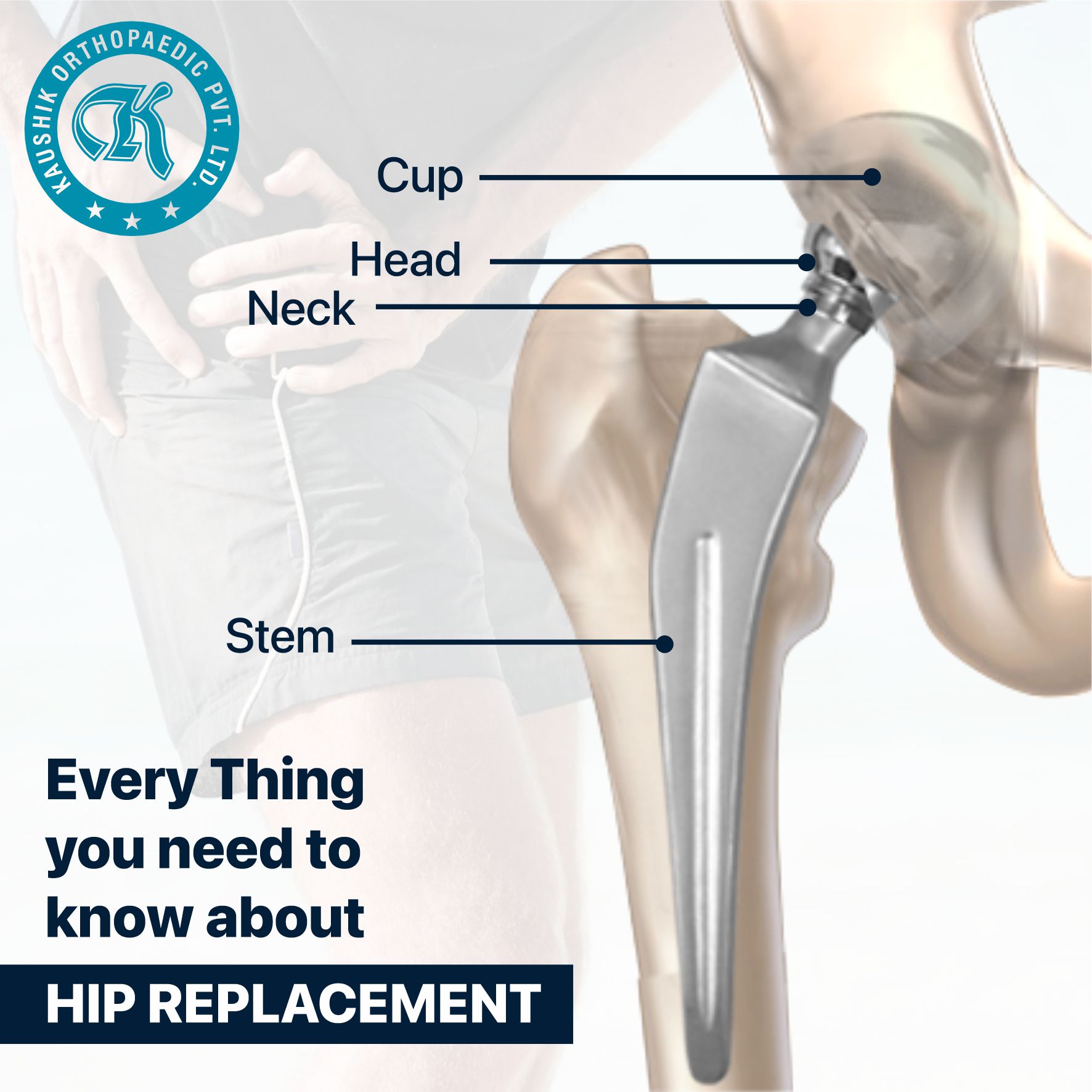 Hip Replacement